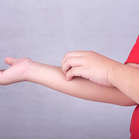 When to Take Your Child to the ER for a Rash | Grand Strand Physicians